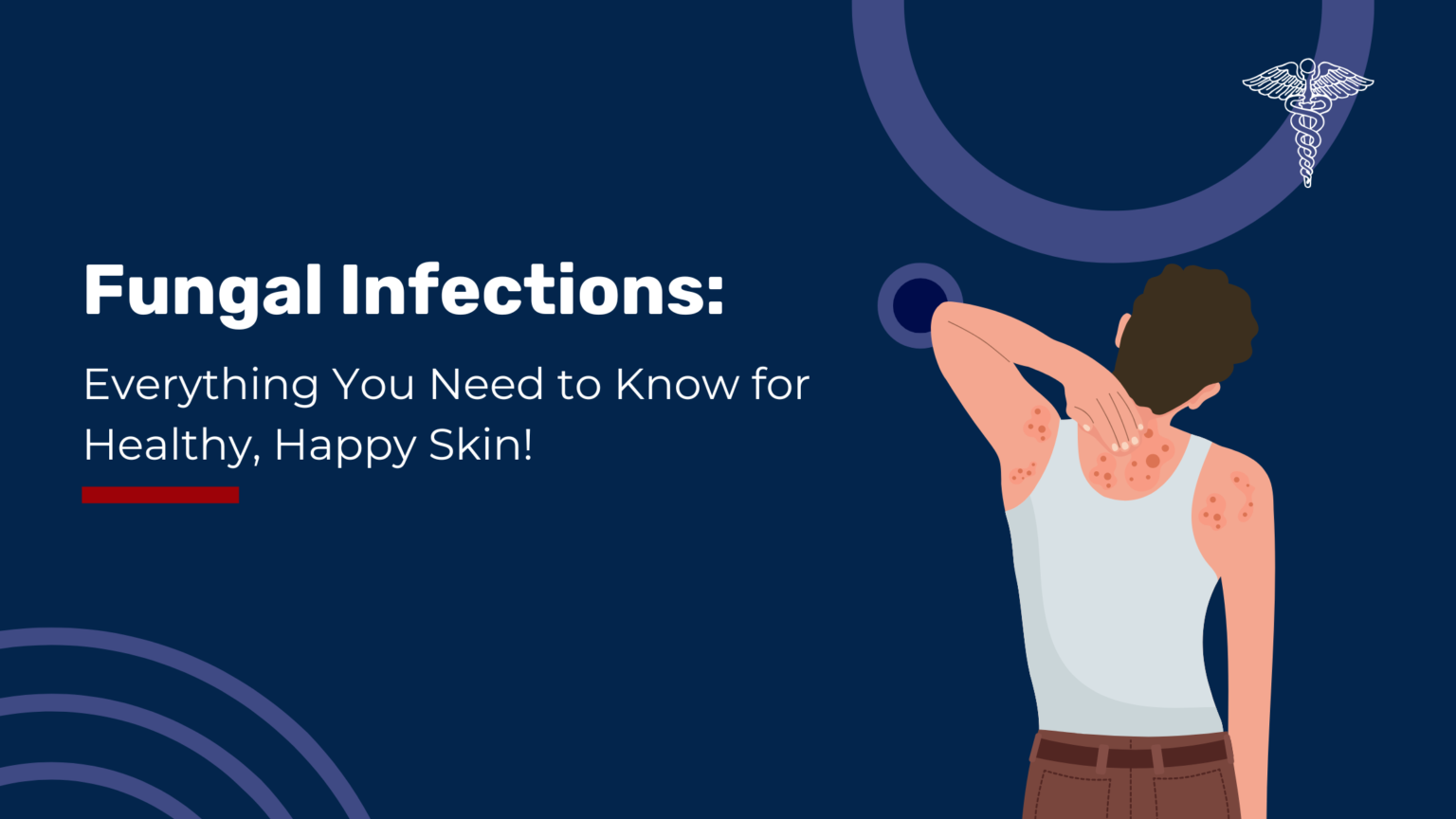 Fungal Infections: Everything You Need to Know for Healthy, Happy Skin ...